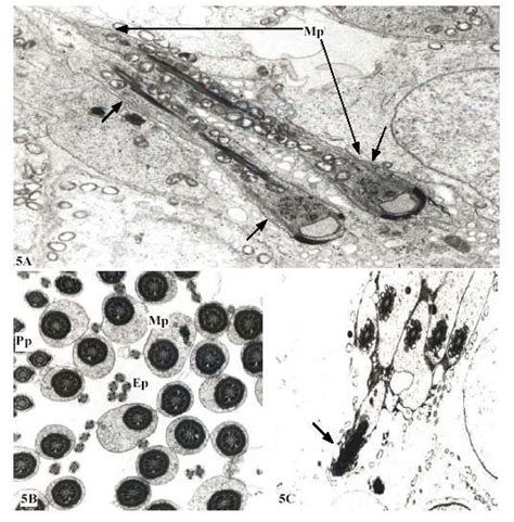Electron Micrographs Of Testis Sections From A Control Rats Showing