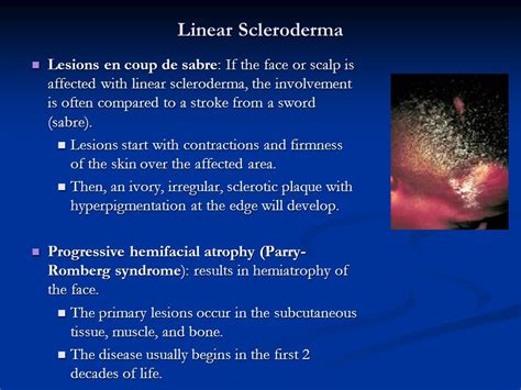 Crest Scleroderma Scalp