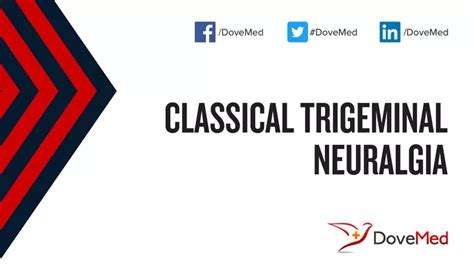 Classical Trigeminal Neuralgia Dovemed