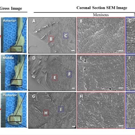 Comparison Between The Circumferential Tensile Modulus Of The Meniscus