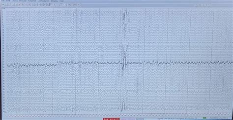 The Nyquist Frequency Lunatic Laboratories