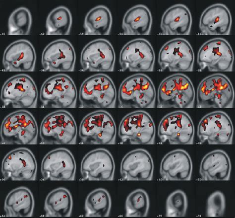 Inverted ‘u Response To Increasing Amount Of Prosodic Information