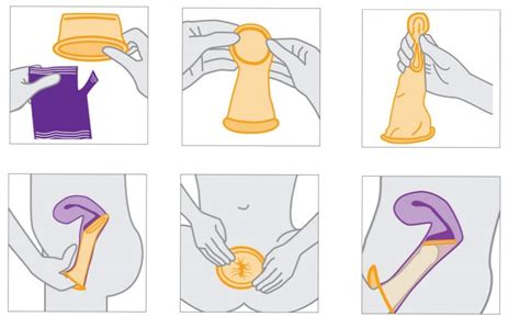 Cara Agar Tidak Hamil Yang Paling Populer Di Indonesia Apa Saja Good Doctor Tips