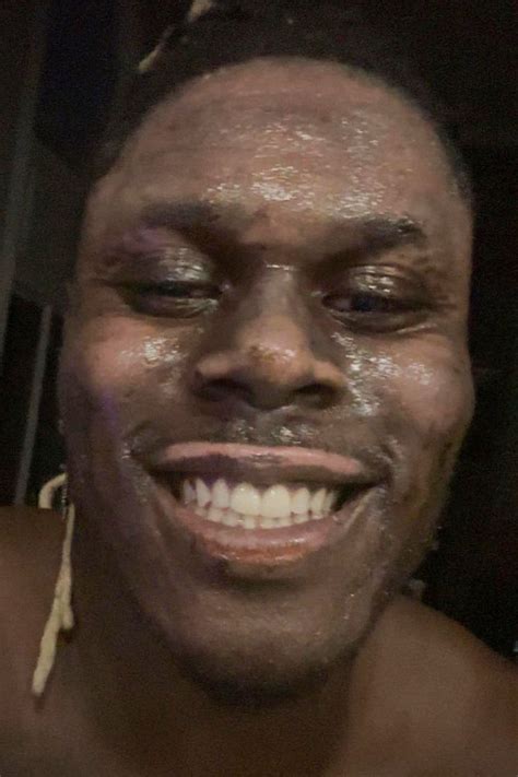 Cleveland Browns David Njoku Shares First Pictures Of Facial Burns