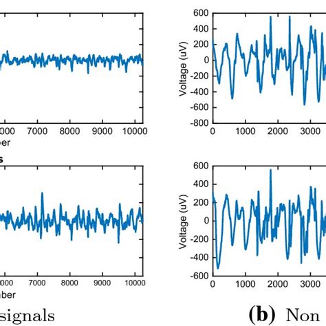 Samples Of Focal And Nonfocal Eeg Signals For The X And Y Series Download Scientific Diagram