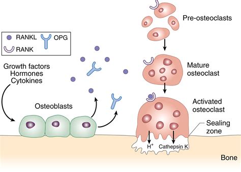 Osteoporosis Clinical Tree