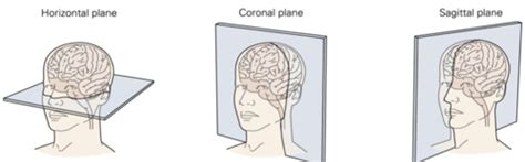 Pga Neuro Flashcards Quizlet
