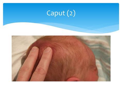 Ppt Normal Newborn Care Powerpoint Presentation Free Download Id 2313221