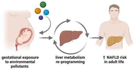 Sex Nutrition And Nafld Relevance Of Environmental Pollution Pmc