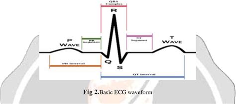 Figure From A Review On Sleep Apnea Detection From ECG Signal Semantic Scholar
