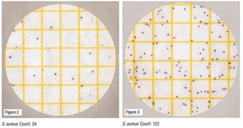 미생물 시험 배지medium의 종류 네이버 블로그