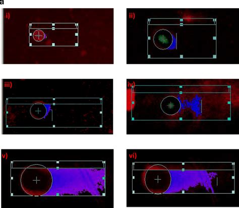Dna Damage In Terms Of Head Dna And Tail Dna In Comet Assay As