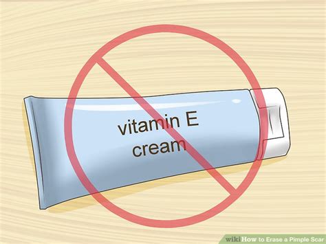Ways To Erase A Pimple Scar Wikihow