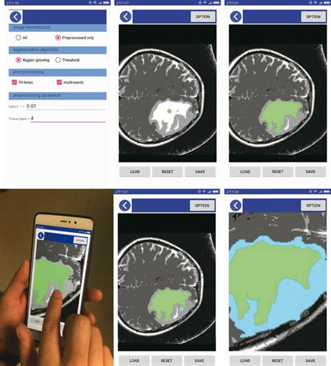 The User Interface On The Mobile Device Download Scientific Diagram