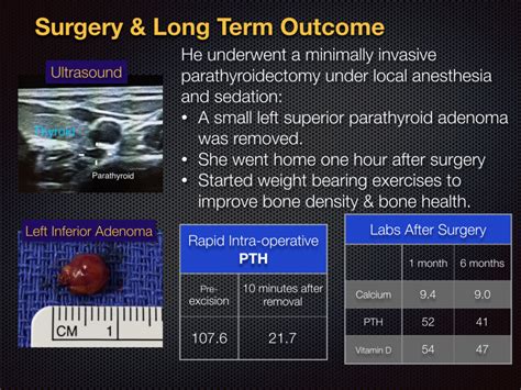 Hyperparathyroidism Diagnosis For Parathyroid Disease Dr Larian