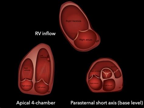 Rvsp How To Saving Lives With Sound