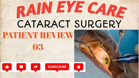 Cataract Surgery Information For Patients