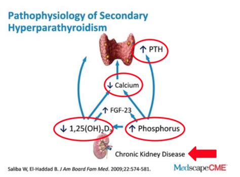 Secondary Hyperparathyroidism