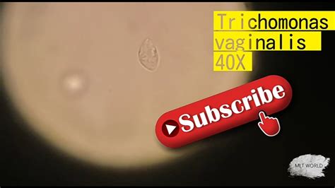 Trichomonas Vaginalis In Urine Under Microscope Urine Parasite Female Uti Best View T V 40x View