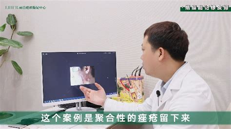 北京丽合医疗美容医院疤痕胎记：疤痕疙瘩增生后到底如何修复 腾讯视频