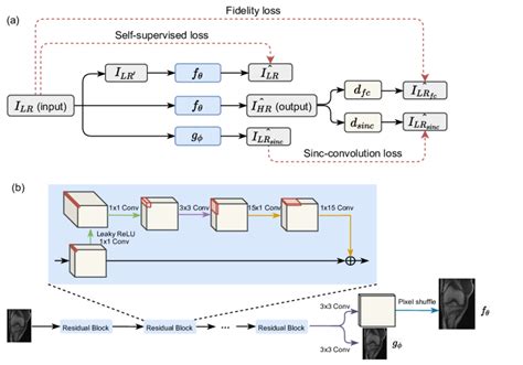 A The Proposed Unsupervised Framework Usrgr For Mri Sr And Gibbs Download Scientific Diagram