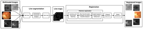 overview of the processing pipeline download scientific diagram