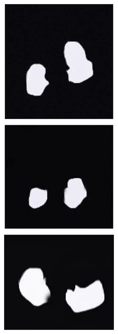 Segmentation Results Of Different Models A Original Image B Download Scientific Diagram