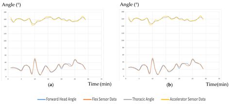Posture Monitoring During Breastfeeding Smart Underwear Integrated With An Accelerometer And