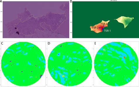 Figure 2 From Deep Learning Based Tumorstroma Ratio Scoring In Colon