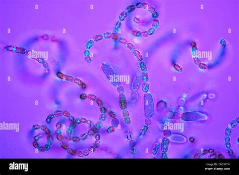 Anabaena Cyanobacteria Polarised Light Micrograph Of Filamentous Colonies Of Anabaena Sp