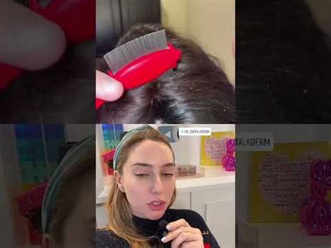 Should You Remove Psoriasis Plaques