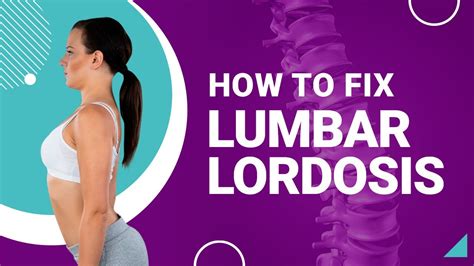 Lordosis Symptoms Youtube Lordosis Dr Jason Lowenstein