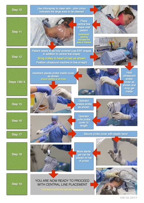 Arterial Line Artofit
