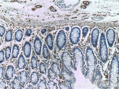 Vimentin（ビメンチン）抗体 免疫組織化学染色（ihc）適用！520報以上の文献使用実績！間葉系細胞で発現する中間径フィラメントを検出 コスモ・バイオ株式会社