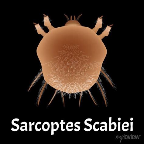 Sarcoptes Scabiei Scabies Sexually Transmitted Disease Infographics