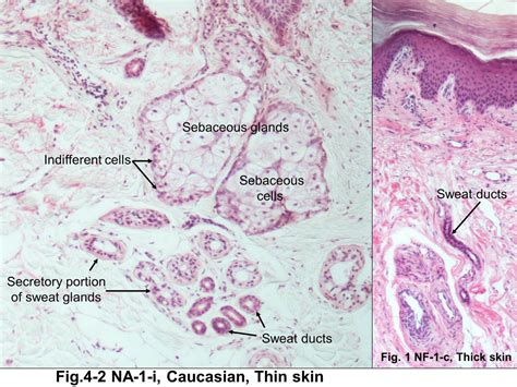 Sweat Gland Histology