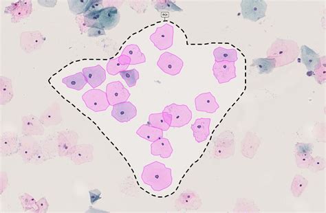 Pathology Image Annotation Done Right