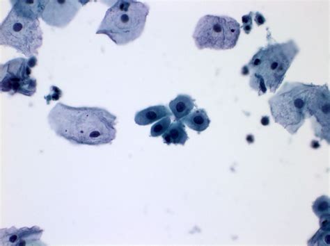 Pathology Outlines Normal And Nonneoplastic Findings