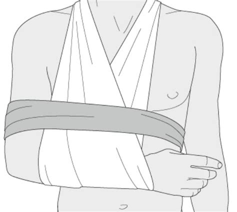 Fracture Splints Why Splint A Fracture Bone And Spine
