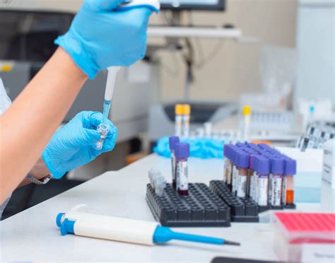 Laboratory Services Jefferson Healthcare