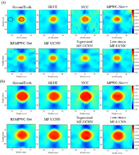 figure 3 from unsupervised convolutional neural network for motion