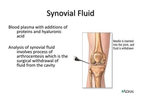 Turbid Synovial Fluid At Alison Mclemore Blog