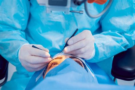 Astigmatic Keratotomy Eye Surgery For Astigmatism Correction