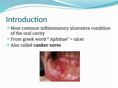 Aphthous Ulcer Oral Medicine And Radiology Pptx