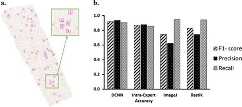 A Deep Convolutional Neural Network For Efficient Microglia Detection Scientific Reports