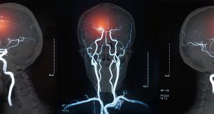 8 Reasons Why You Might Be Crying After Sex