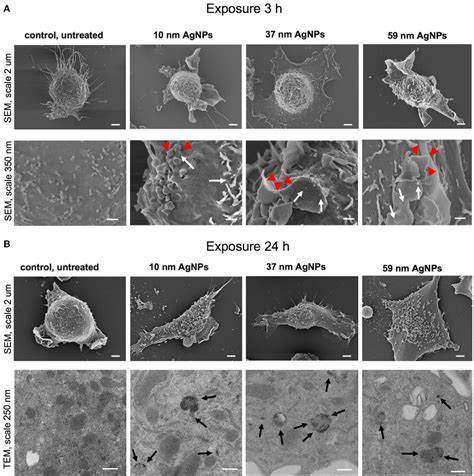 Tem Vs Sem Microscopy