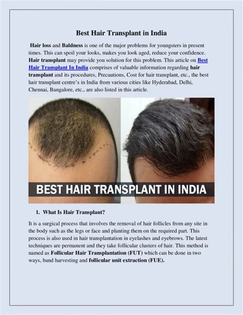 Ppt Best Hair Transplant In India Medihair India Powerpoint