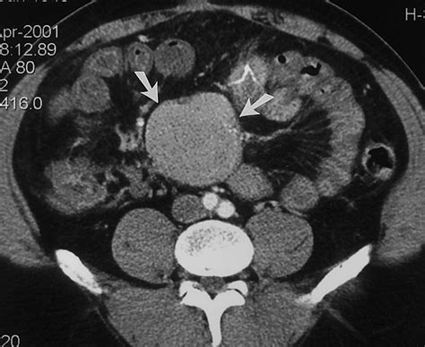 Differential Diagnosis Radiology At William Emery Blog