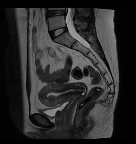 Radiology Female Sagittal Pelvis 8 Diagram Quizlet